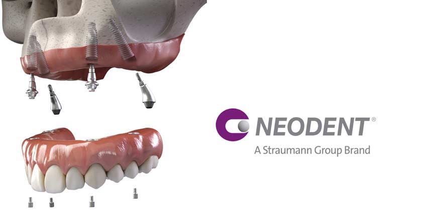Why Advanced Dentistry & Implants Uses Neodent Implants – Advanced ...